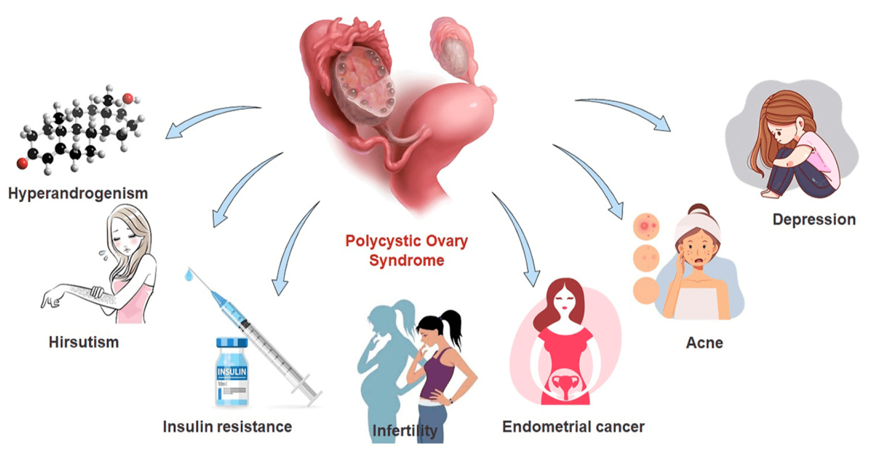 PCOS - iSHA Care